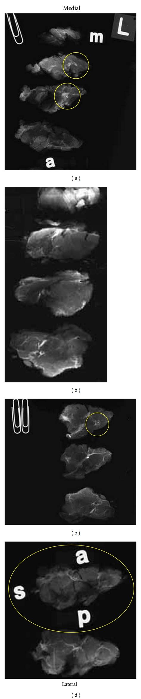 Specimen Radiographs Of A Lumpectomy From A Left Breast Sectioned At Download Scientific