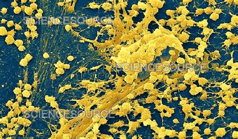 Eps Staphylococcus Biofilm Sem Stock Image Science Source Images