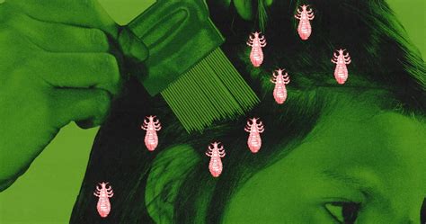 Do I Need Professional Treatments To Get Rid Of Head Lice