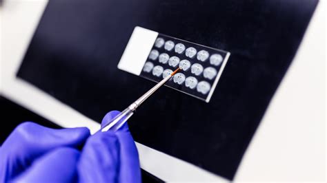 Brain Science Management Team Allen Institute