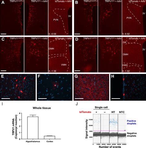 Figure 1 From Interaction Between Trpv1 Expressing Neurons In The