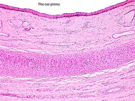 The Ear Dr Kasem Histology Homepage