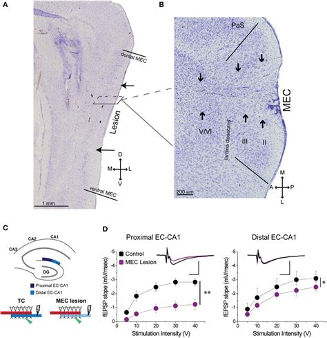 Mec Lesions Diminished Ec Ca1 Synaptic Transmission In The Proximal