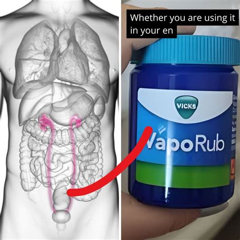 Put Vicks Vaporub On This Place Artofit