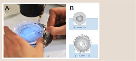 Zebrafish Embryo Injection Part