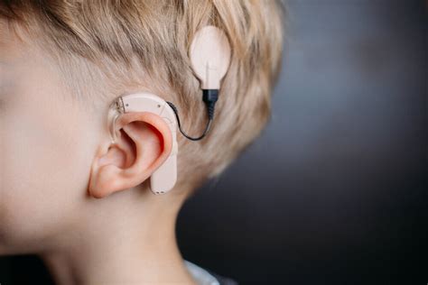Cochlear Implant For Single Sided Deafness Improves Tinnitus And Vertigo