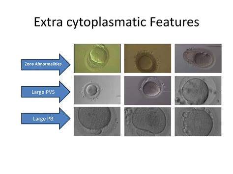 Oocyte And Embryo Grading Blastocyst Grading Pptx