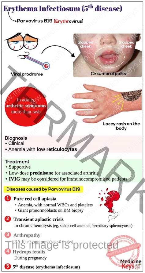 Fifths Disease Nhs At John Heidt Blog