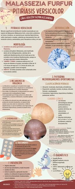 Infografía Pitiriasis Versicolor Yazmin La Udocz