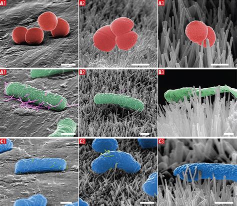 Characterisation Of Bactericidal Titanium Surfaces Using Electron