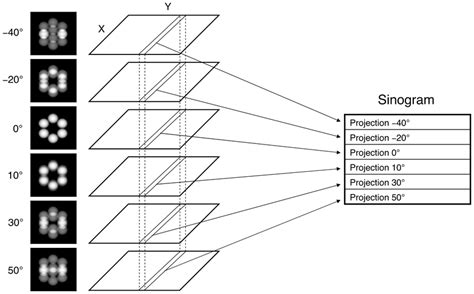 How A Sinogram Is Built All Projection Images Are Stacked And The 1d