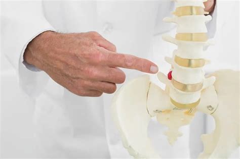 Tratamiento De Fracturas Vertebrales Por El Dr Diego Zavala Van Rankin