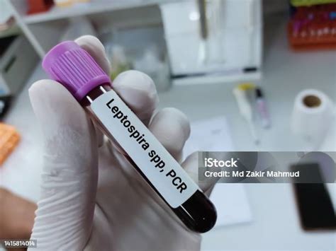 과학자의 생화학자가 렙토스피라 종 Pcr 검사를 위해 혈액 샘플을 들고 있습니다 0명에 대한 스톡 사진 및 기타 이미지 0명