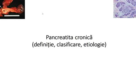 Pancreatită cronică IASGO Academy
