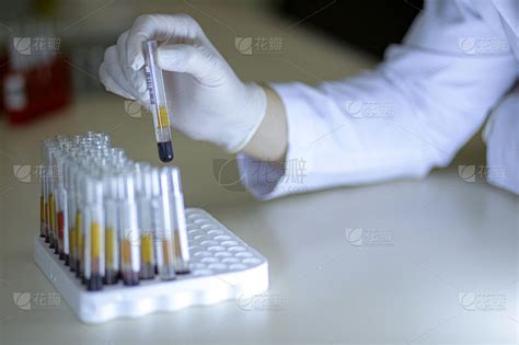 血液样本库存照片