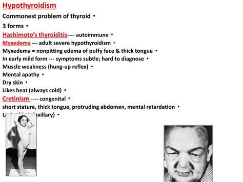 Endocrine Pptx