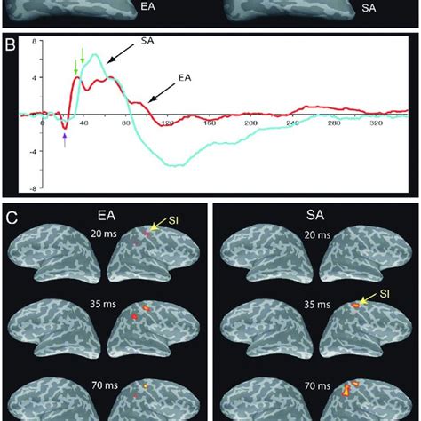 Equivalent Current Dipole Ecd And Distributed Source Analysis Of Download Scientific Diagram