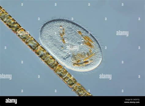 Frontonia Protozoan Light Micrograph Of A Frontonia Sp Ciliate