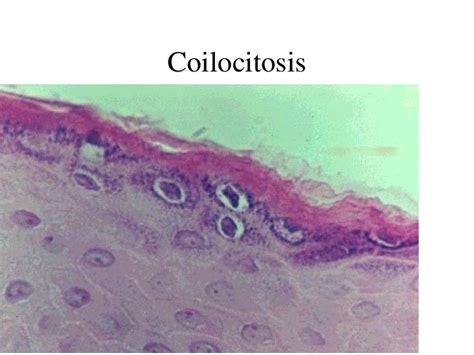 20b Vce Ipogcombrimageshtm