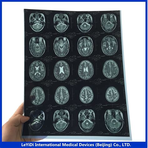 Hospital Radiography X Ray Film Blue Color Inkjet Image For Ct China