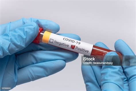 코로나 바이러스에 혈액 양성 검사 의료 Reseach 혈액 테스트 튜브 라텍스 의료 장갑에 손 코로나 바이러스 발생 및