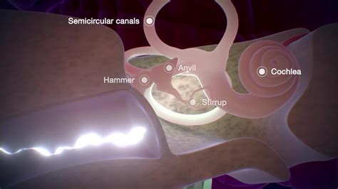 Otitis Media Serous Otitis Media Serous Merck Manual Consumer