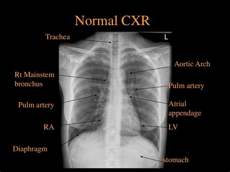 Radiology Chest Imaging