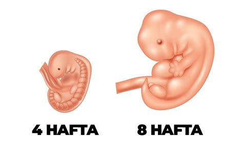 Hafta Hamilelik Geli Imi Nas Ld R Op Dr Smet Y Ld R M