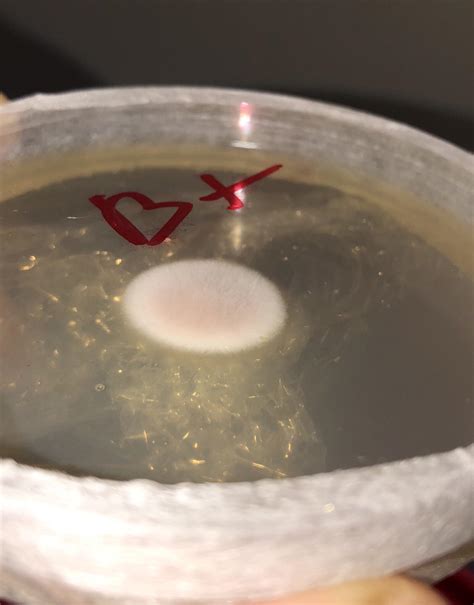 How Does This Agar Look Made From Ms Syringe Rshroomers