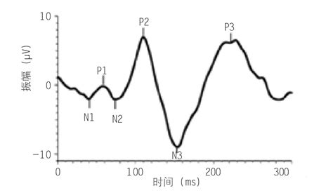 第四节 视觉诱发电位 VEP 神经眼科诊疗 医学