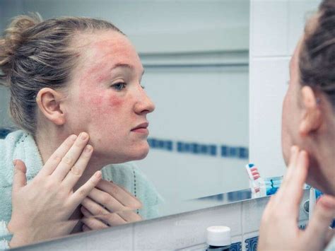 Acetaminophen 10 Side Effects Of Acetaminophen