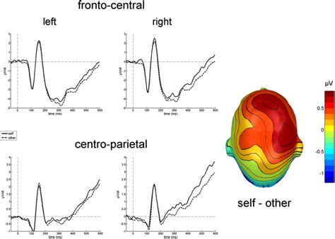 Illustration Of The Lpp Component Showing Left And Right Frontal Upper Download Scientific