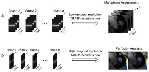 Free Breathing Dynamic Contrast Enhanced Mri For Assessment Of Pulmonary Lesions Using Golden