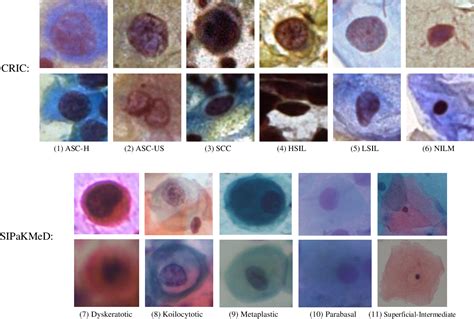 figure 4 from cvm cervix a hybrid cervical pap smear image