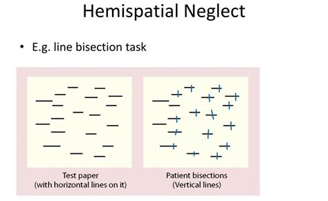 Printable Line Bisection Test Pdf Albert S Cancellation Task 6