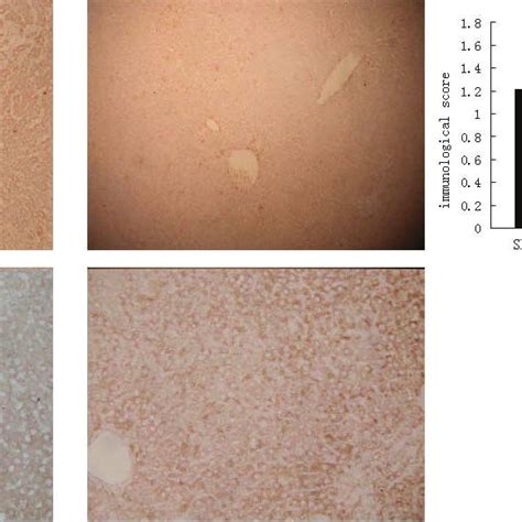 hepatic cse protein expression immunohistochemical staining of hepatic