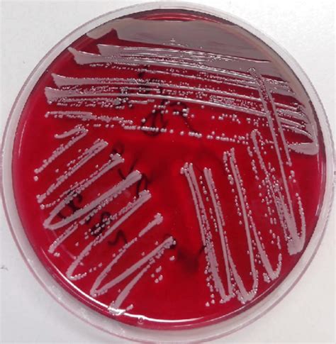 Staphylococcus And Streptococcus Flashcards Quizlet