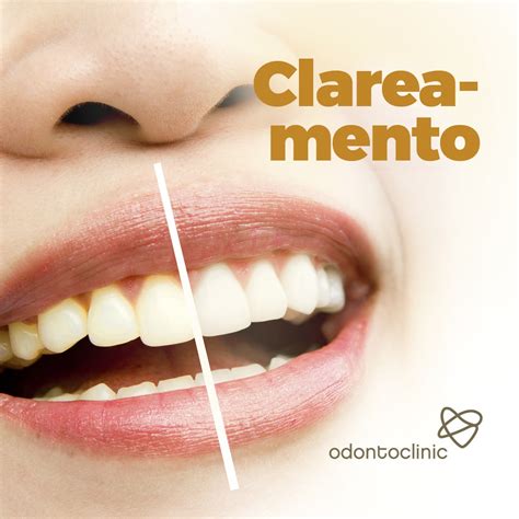 Odontoclinic Dentista Em Londrina