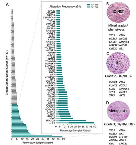 Genomic Alterations Across Breast Cancers A Frequency Of Genomic