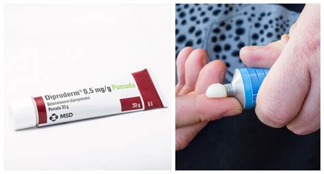 Diproderm Usos Y Efectos Secundarios Mejor Con Salud