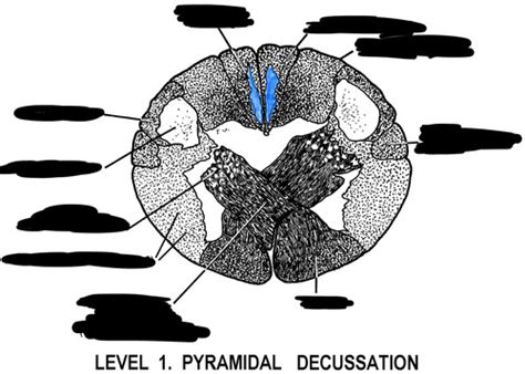 Neuroanatomy Brain Stem Cross Section Quiz Flashcards Quizlet