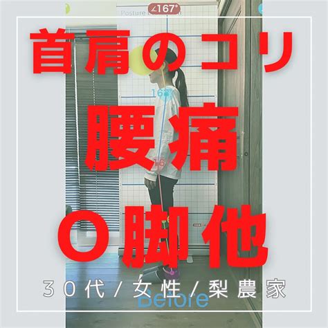 【富里 整体】o脚、腰痛、首肩のコリ 他30代女性梨農家 ブログ 富里で整体ならグッドカイロプラクティック