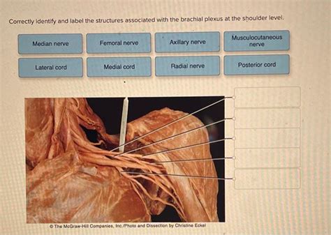 Solved Correctly Identify And Label The Structures Chegg
