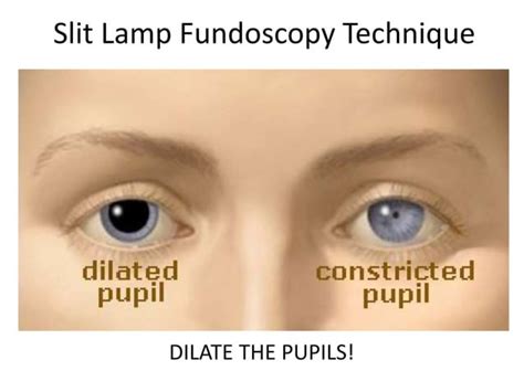 Slit Lamp Fundoscopy Pptx First Aid Injuries