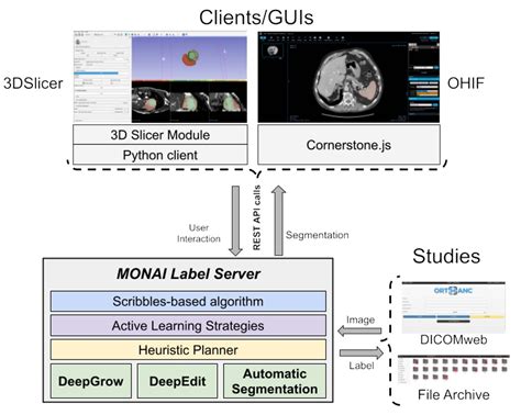 Monai 如何推动医学人工智能工作流的开放研究 Nvidia 技术博客