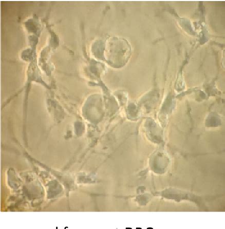 Figure 1 From Patch Clamp Electrophysiology Semantic Scholar