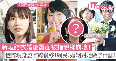 新垣結衣婚後露面被指靚樣崩壞！ 憔悴現身髮際線後移！網民：婚姻對她做了什麼！ U Beauty