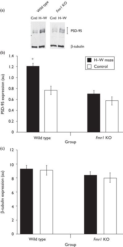 Postsynaptic Density Protein 95 Psd 95 Expression Is Increased In