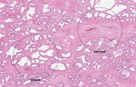 Normal Prostate Histology Histology Slides Branches Of