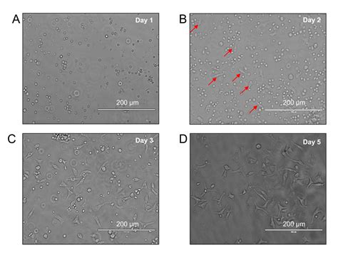 Neonatal Mouse Bone Marrow Isolation And Preparation Of Bone Marrow